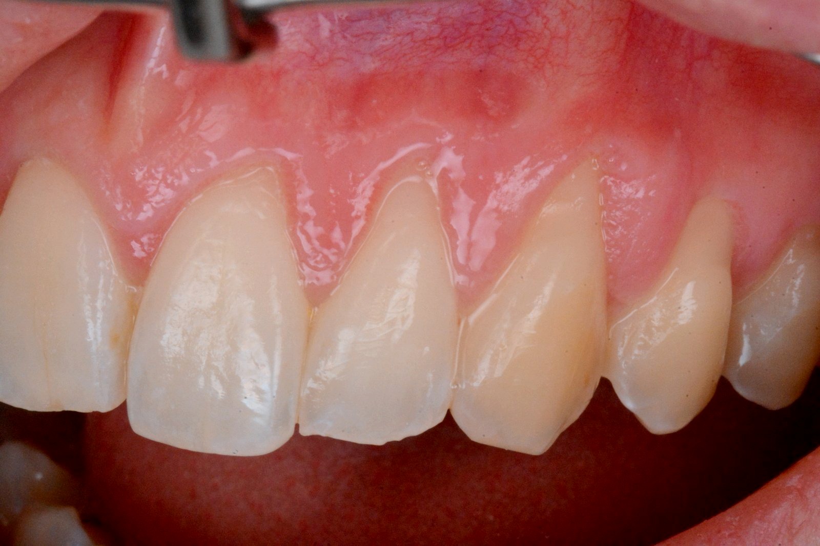 Cabinet Dentaire d'implantologie orale du Docteur Eric Amsellem